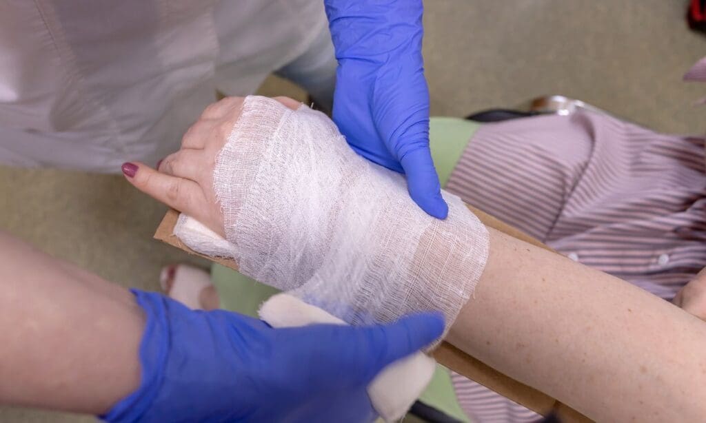 First Aid for Frostbite: Stages and Treatment Options - FITPAA