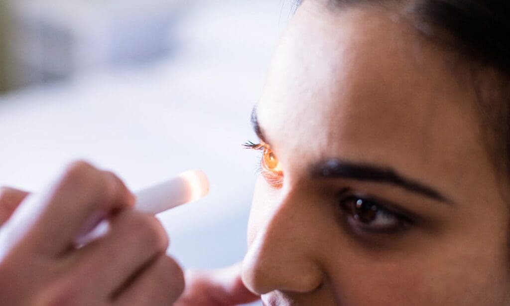 First Aid for Chemical Splash in the Eye: Immediate Care and Rinse - FITPAA