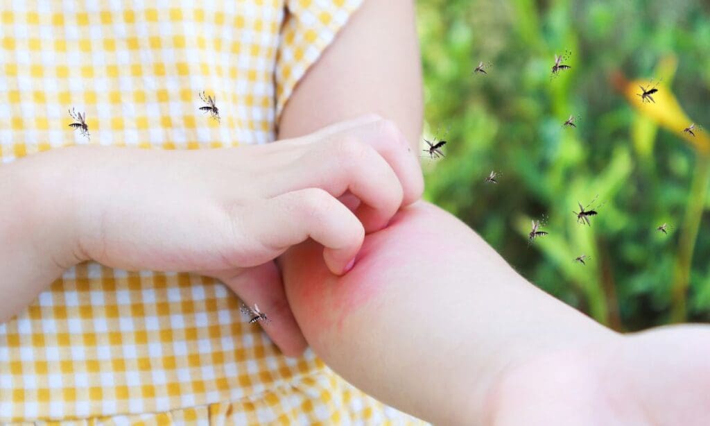 Treating Insect Bites and Stings: First Aid Remedies - FITPAA
