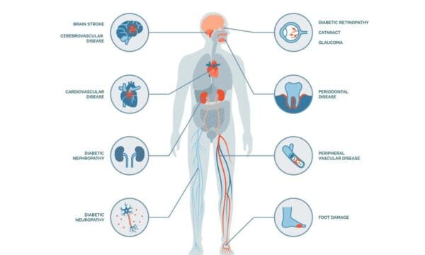 How does diabetes affect the body? - FITPAA
