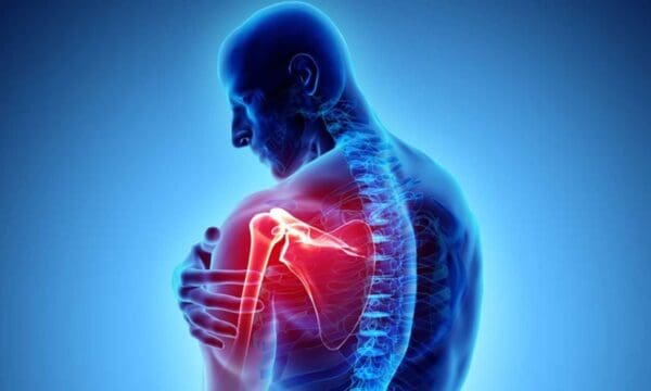 Can shoulder pain be a result of a shoulder joint hemarthrosis? - FITPAA