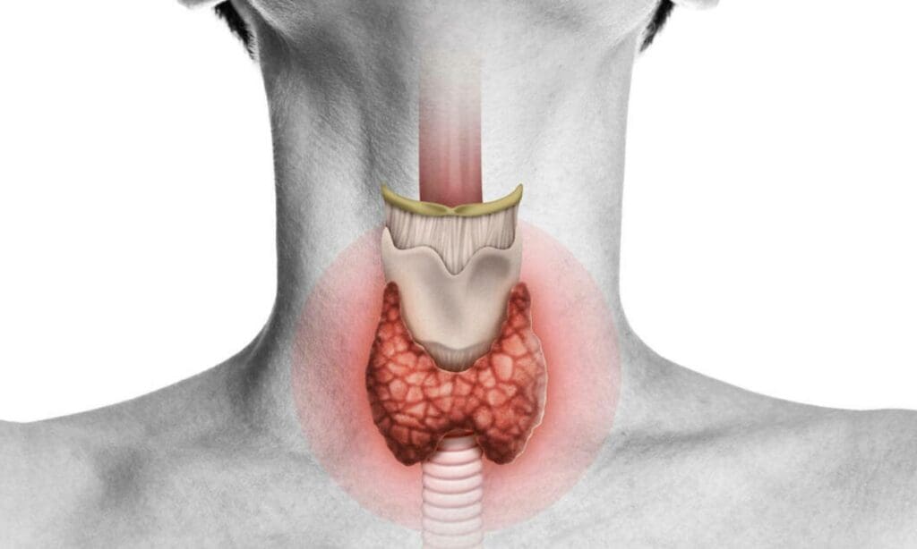 How does thyroid dysfunction influence lipid profiles? - FITPAA