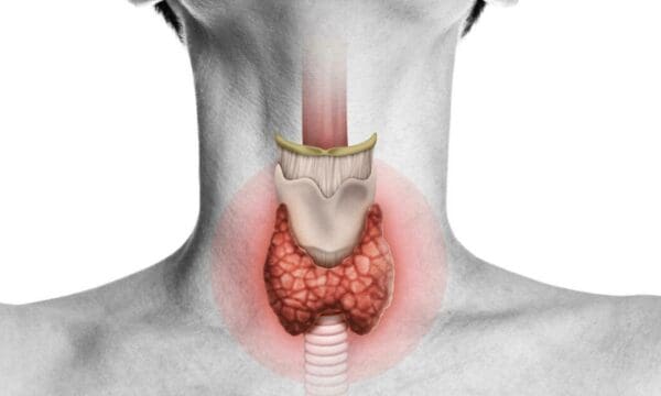How does thyroid dysfunction influence lipid profiles? - FITPAA